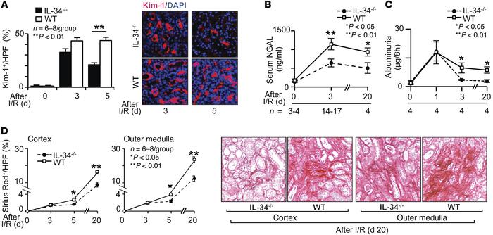 JCI - IL-34 mediates acute kidney injury and worsens subsequent chronic ...
