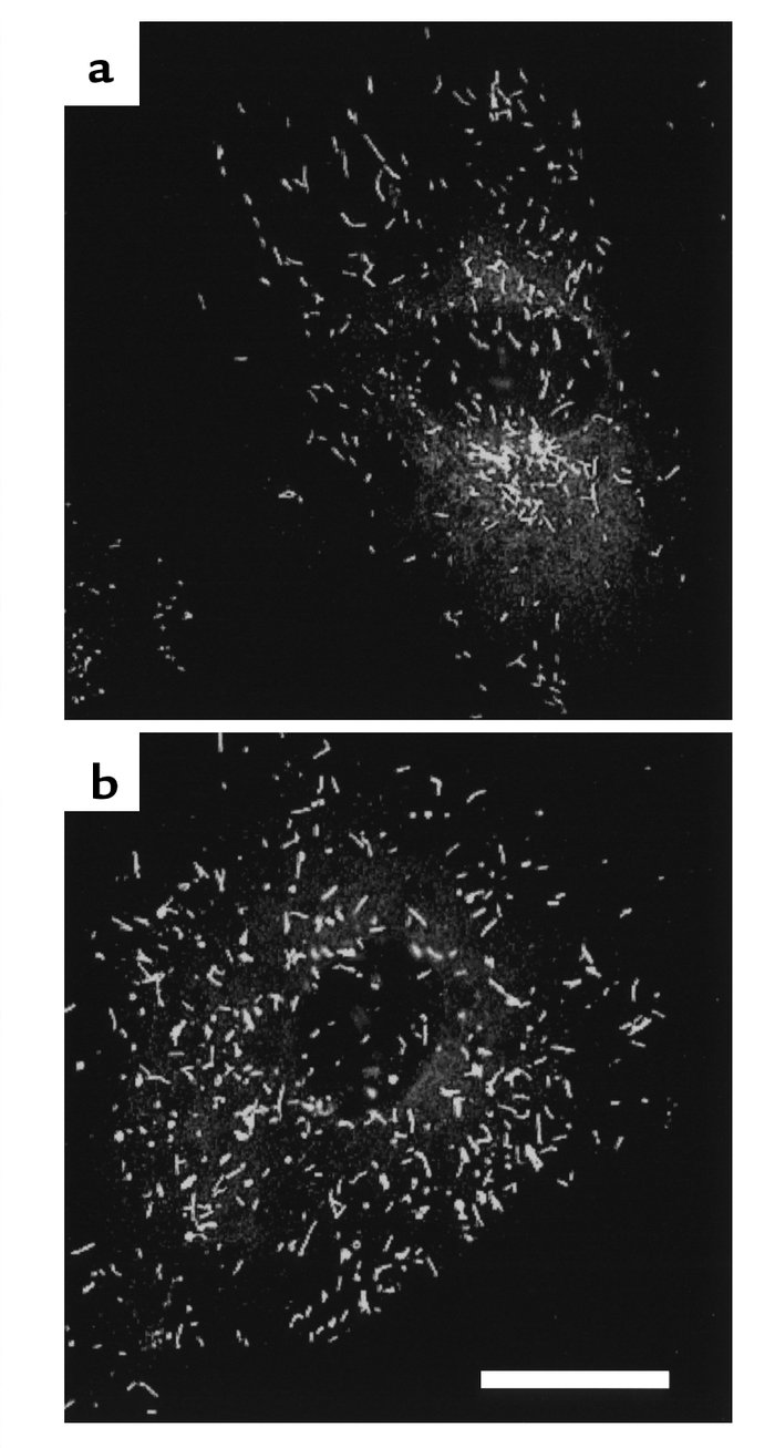 JCI - Vasopressin-induced von Willebrand factor secretion from ...