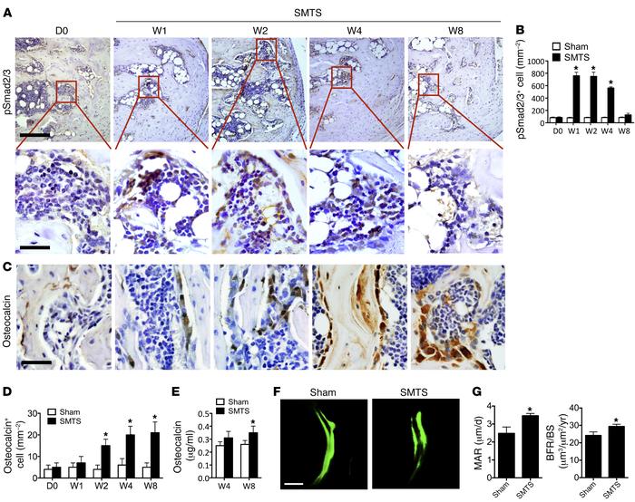 JCI - Aberrant TGF-β activation in bone tendon insertion induces ...