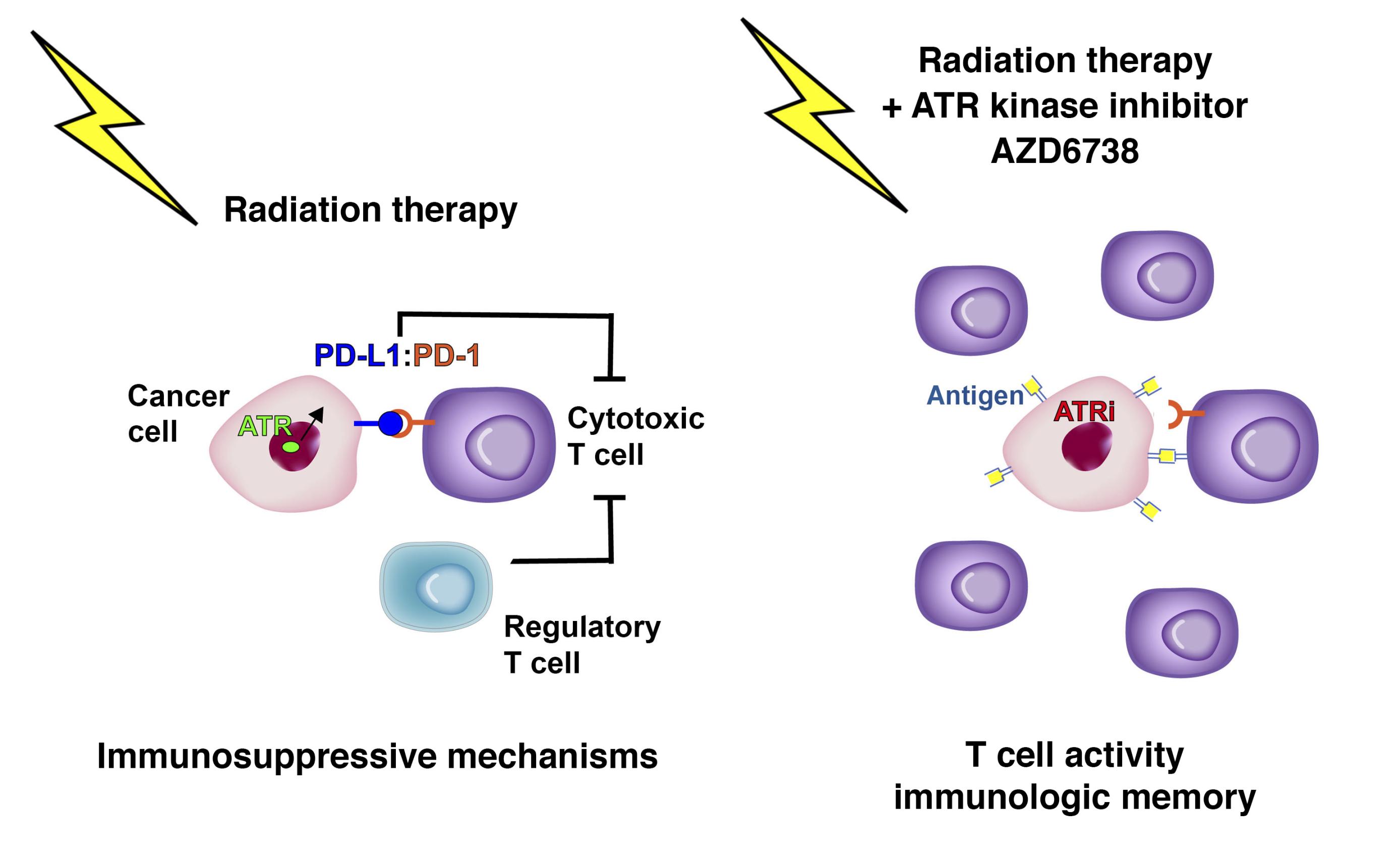 JCI - ATR kinase inhibitor AZD6738 potentiates CD8+ T cell–dependent ...