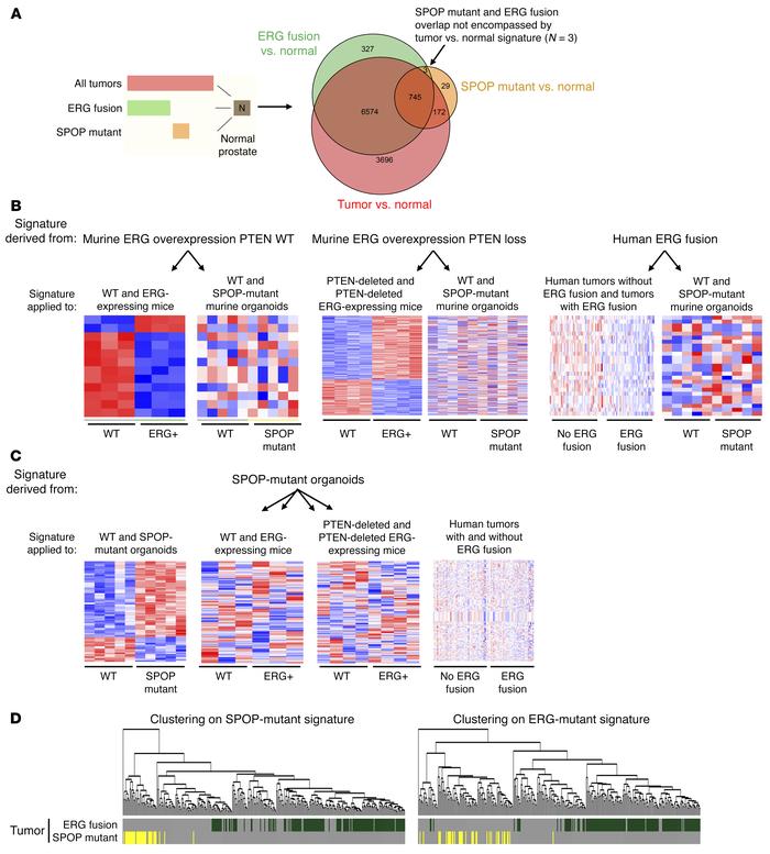JCI - SPOP mutation drives prostate neoplasia without stabilizing ...